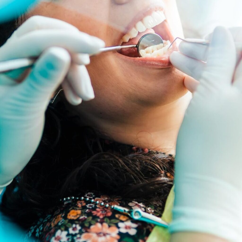 Prosthetic Rehabilitation – Smile Zone